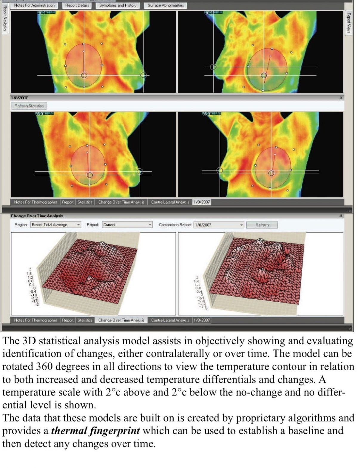 De Meditherm Camera, waarom is deze zo bijzonder? – Thermografie Amsterdam