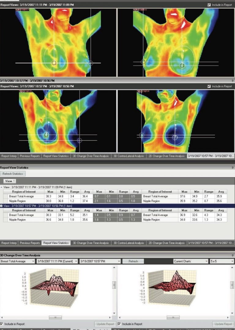 De Meditherm Camera, waarom is deze zo bijzonder? – Thermografie Amsterdam